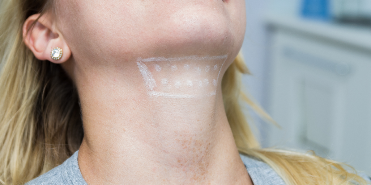The Magic of Kybella - SkinTight MedSpa